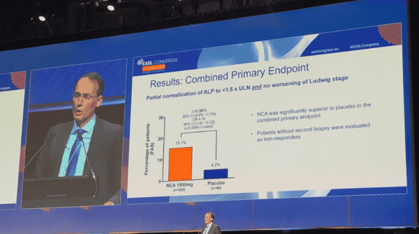 Clinical Trial for Norucholic Acid – Latest Results – PSC Support